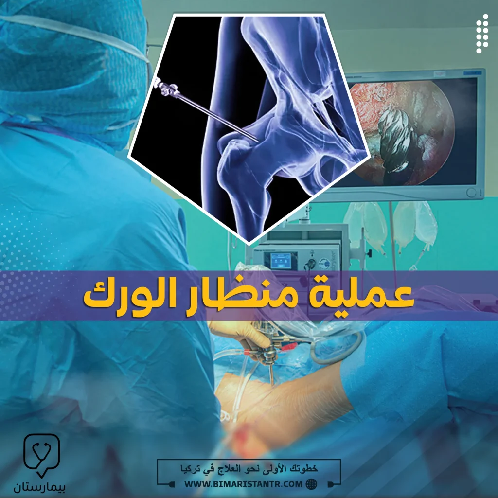 Hip arthroscopy and what you would like to know about this procedure ...